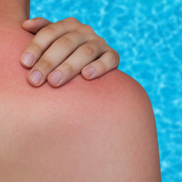 Solve Pool Problems – HTH Pools